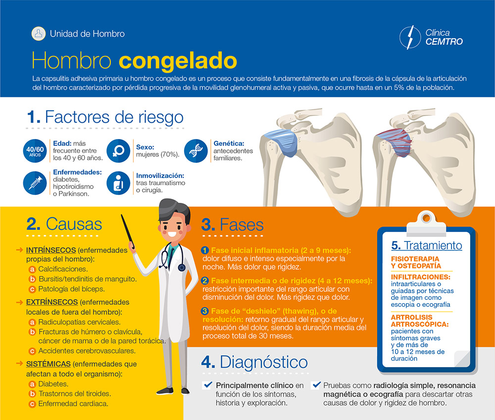 Capsulitis Adhesiva Hombro Congelado - Clínica CEMTRO